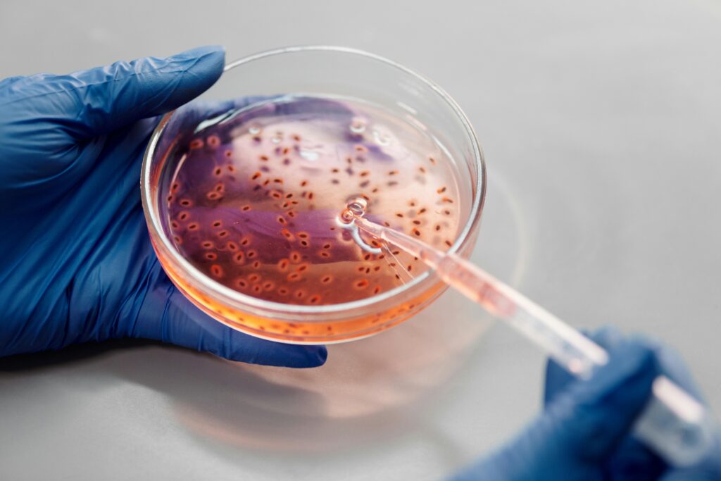 Nuovo Regolamento Ue Listeria: Novità nel 2026 | Studiolab